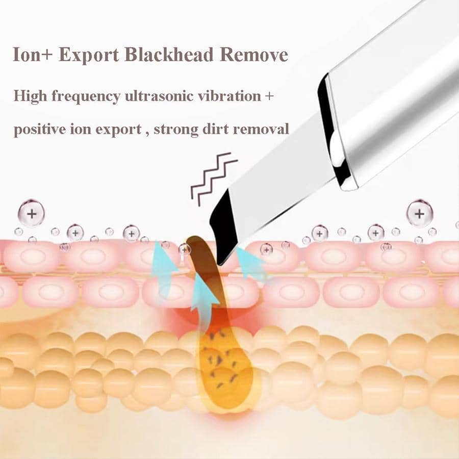 Sonic Skin Scrubber Skin Spatula Peeling Machine Blackhead Remover With ...
