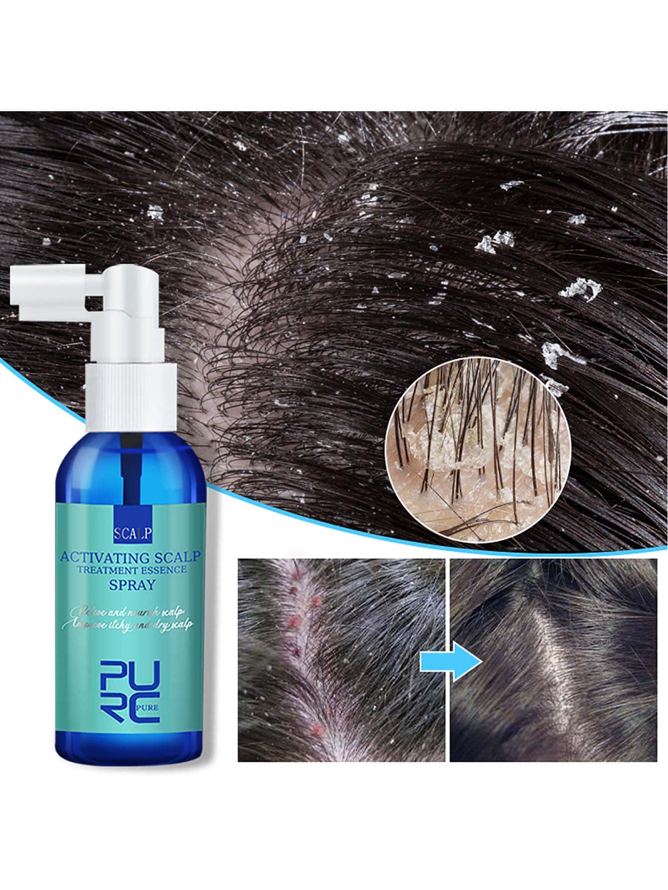 PURC Dandruff Removing Spray - 60ml | SHEIN USA