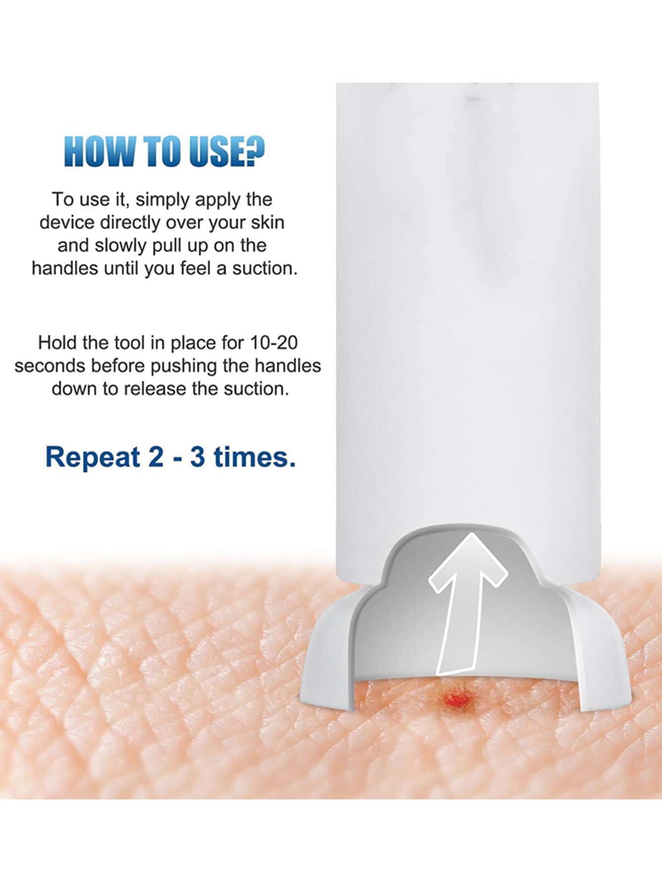 1pc Physical Anti-Itch Tool For Insect Bites - Mosquito Bite Reliever ...