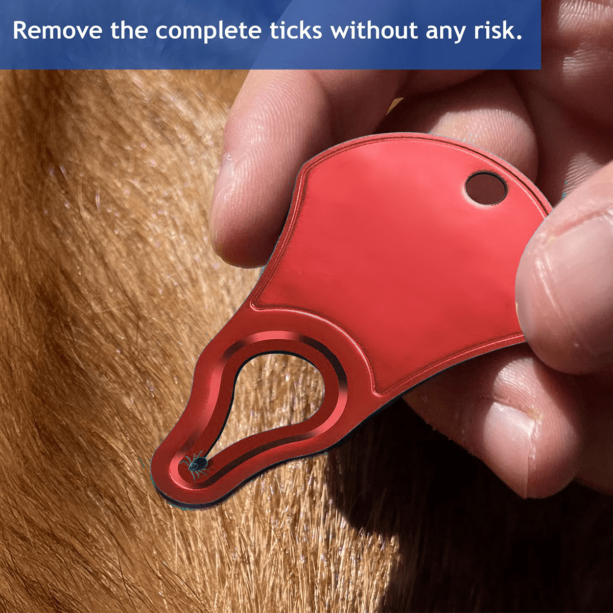 Tick Remover Tool Portable, Tick Removal for Pet and Humans, Safe and ...