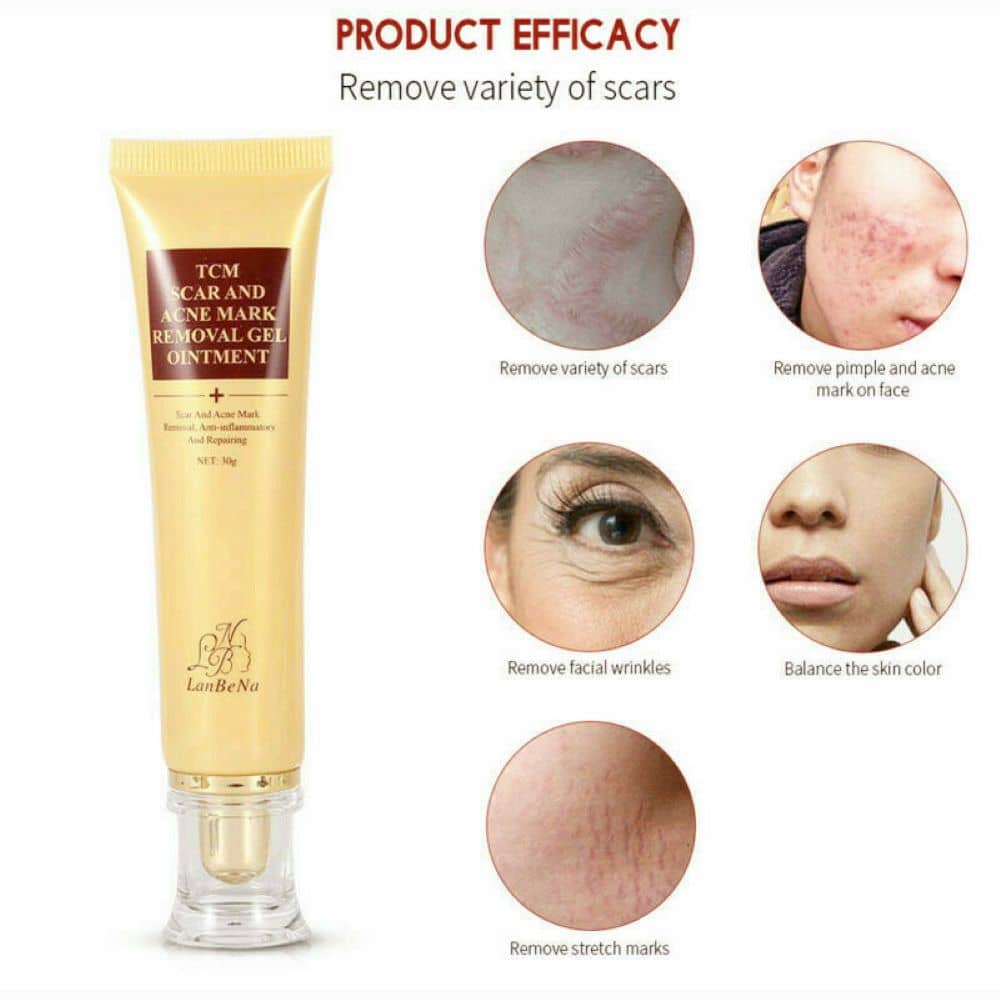 LANBENA Pimple Scar Acne Mark Spots Removal Treatment Gel Ointment ...