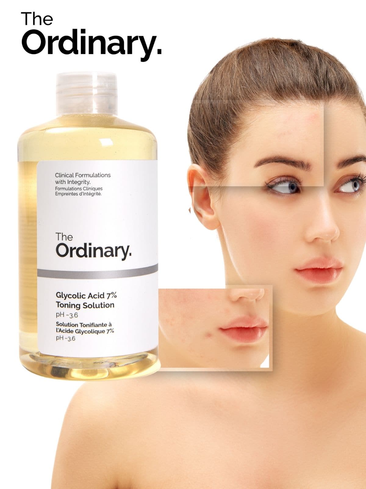 The Ordinary Tonico Toning Solution The Ordinary Glycolic Acid 7% 240 ...
