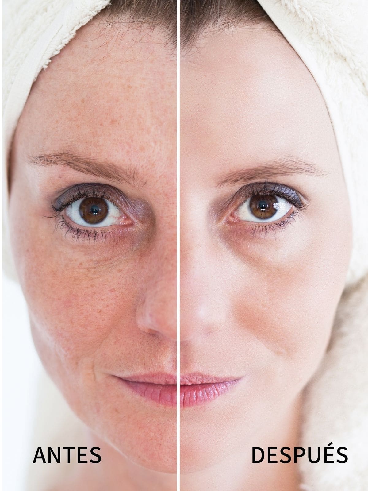 The Ordinary Tonico Toning Solution The Ordinary Glycolic Acid 7% 240 ...