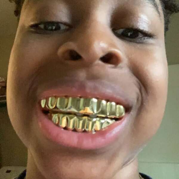 1set Of Luxurious & Elegant 6pcs Solid Color Hip Hop Teeth Grillz ...