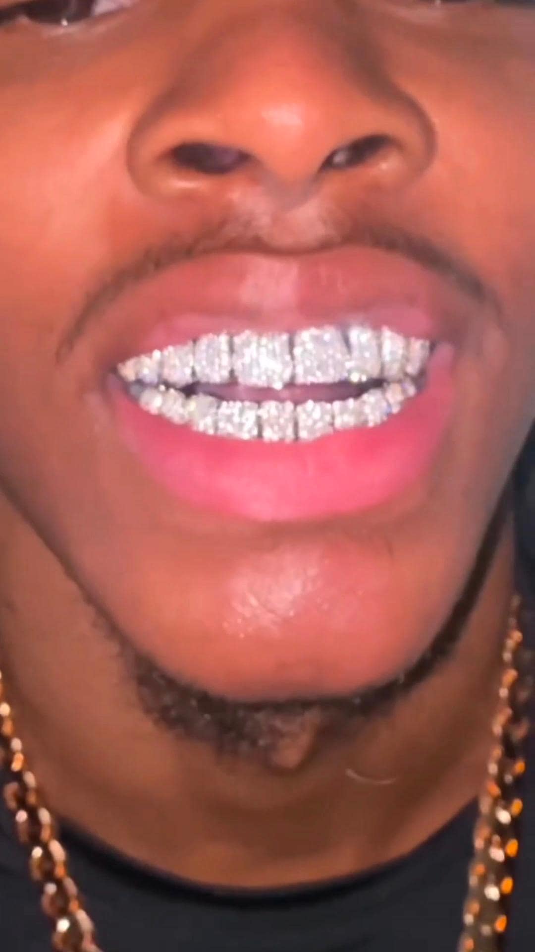 Full Rhinestone Gold Teeth Grillz For Party Decoration | SHEIN EUR