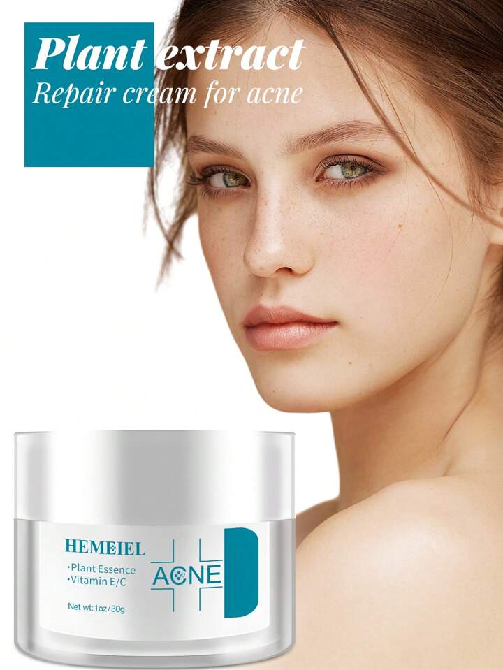 Acne Treatment Cream
