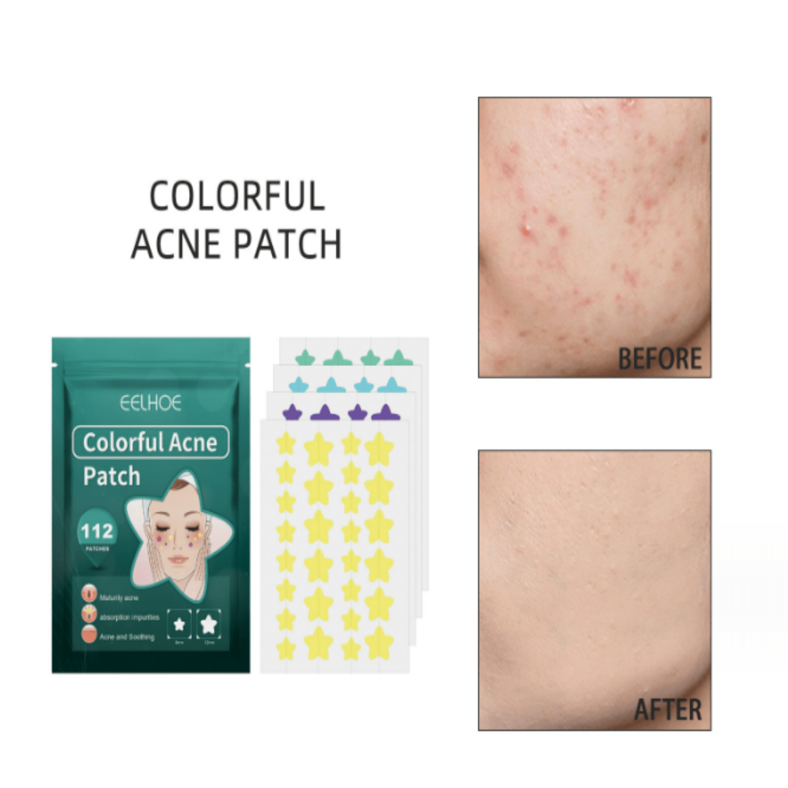 Acne Patch Moles Skin Tags Gram Verruca Corns Spot Patch Skin Clear ...