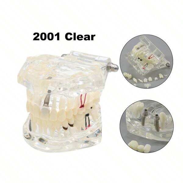 Comprehensive dental pathology model without missing teeth Crystal ...