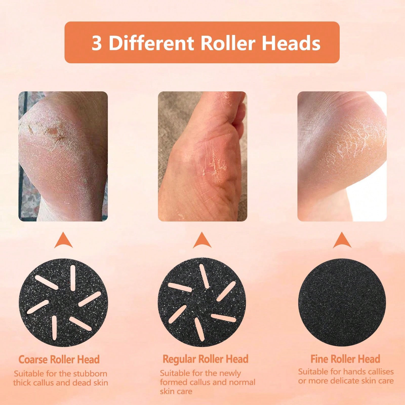 Electric Foot Callus Remover, Rechargeable Vacuum Callus Remover, 3 ... Electric Foot Callus Remover, Rechargeable Vacuum Callus Remover, 3 ...