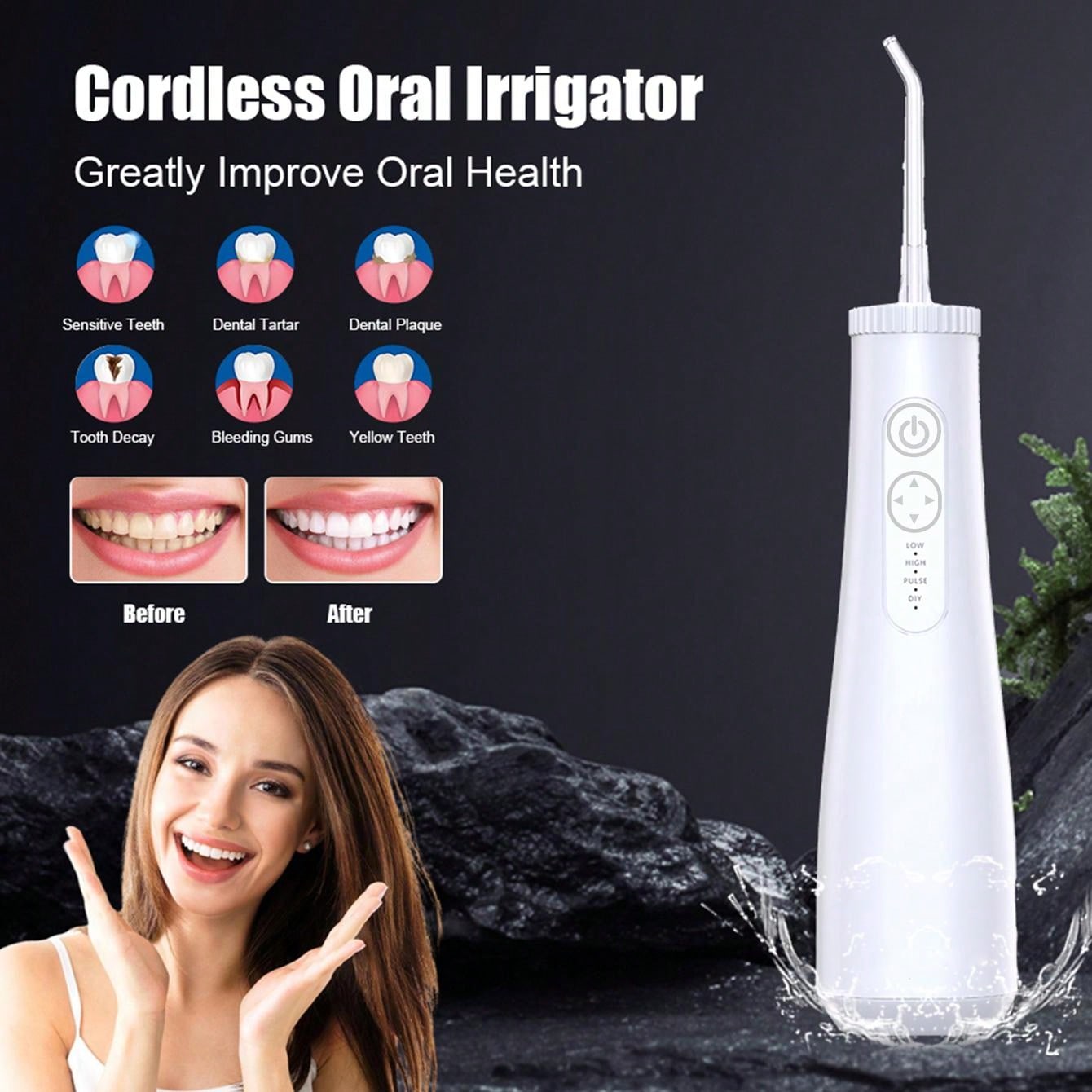 Water Dental Flosser Teeth Pick: Portable Cordless Oral Irrigator 300ML ...