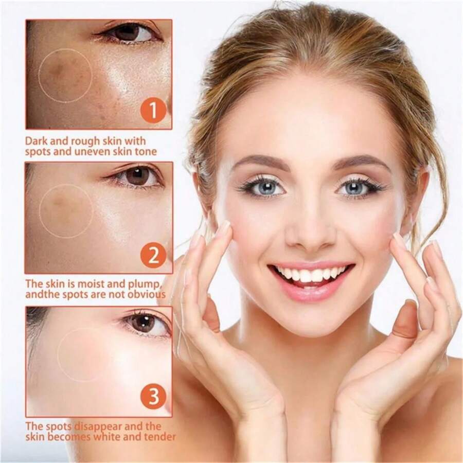 Effective Whitening Freckle Cream Remove Dark Spot Face Cream Removal ...