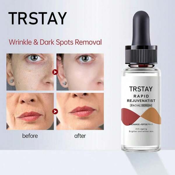 Essência Nicotinamida Trstay De 5ml/15ml/30ml/50ml Que Pode Remover ...