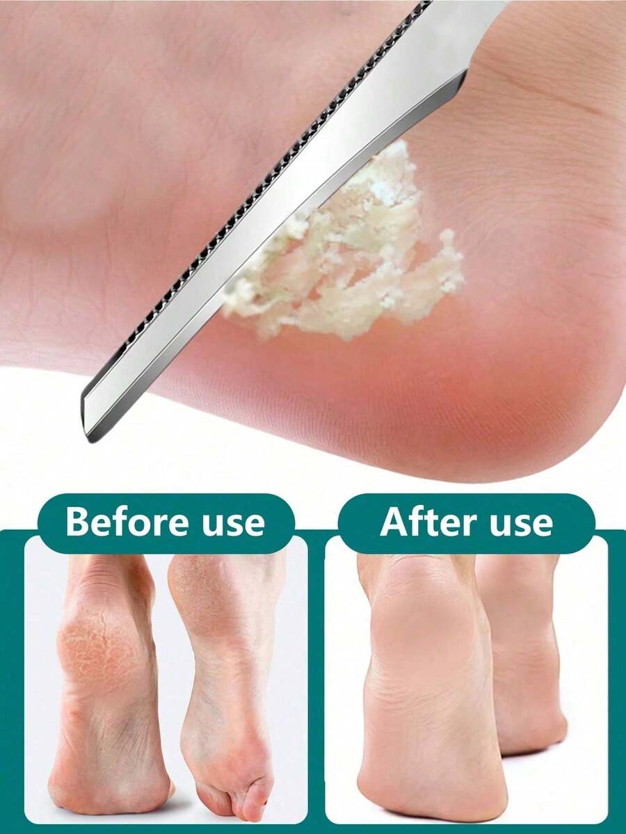 1pc Professional Stainless Steel Foot Care Tool With Dead Skin Remover ...