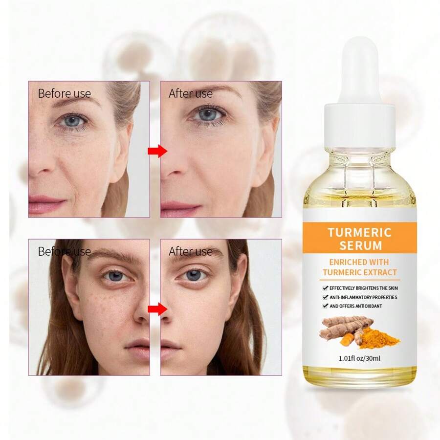 Whitening & Spot Correcting Essence Turmeric Serum, For ...