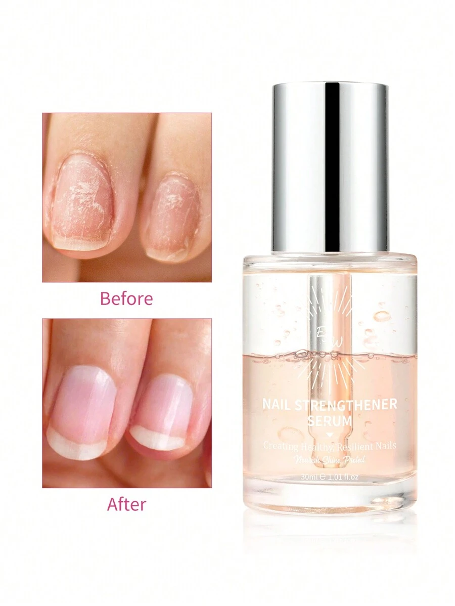 30ml Nail Strengthener Serum - Nail Growth Treatment For Thin, Weak ...