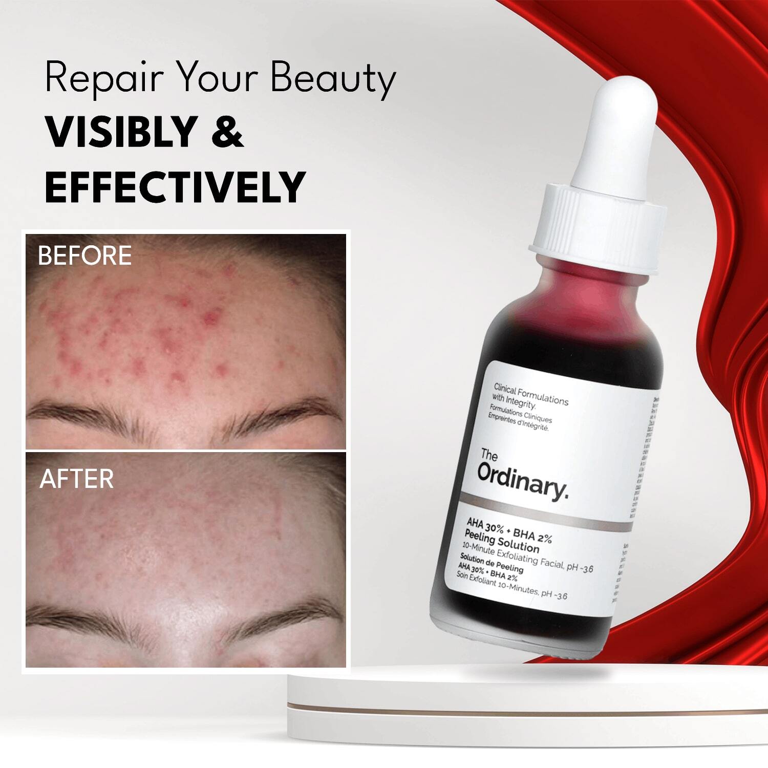 The Ordinary AHA 30% + BHA 2% Peeling Solution 1Oz/ 30ML X 2 (Pack Of 2 ...