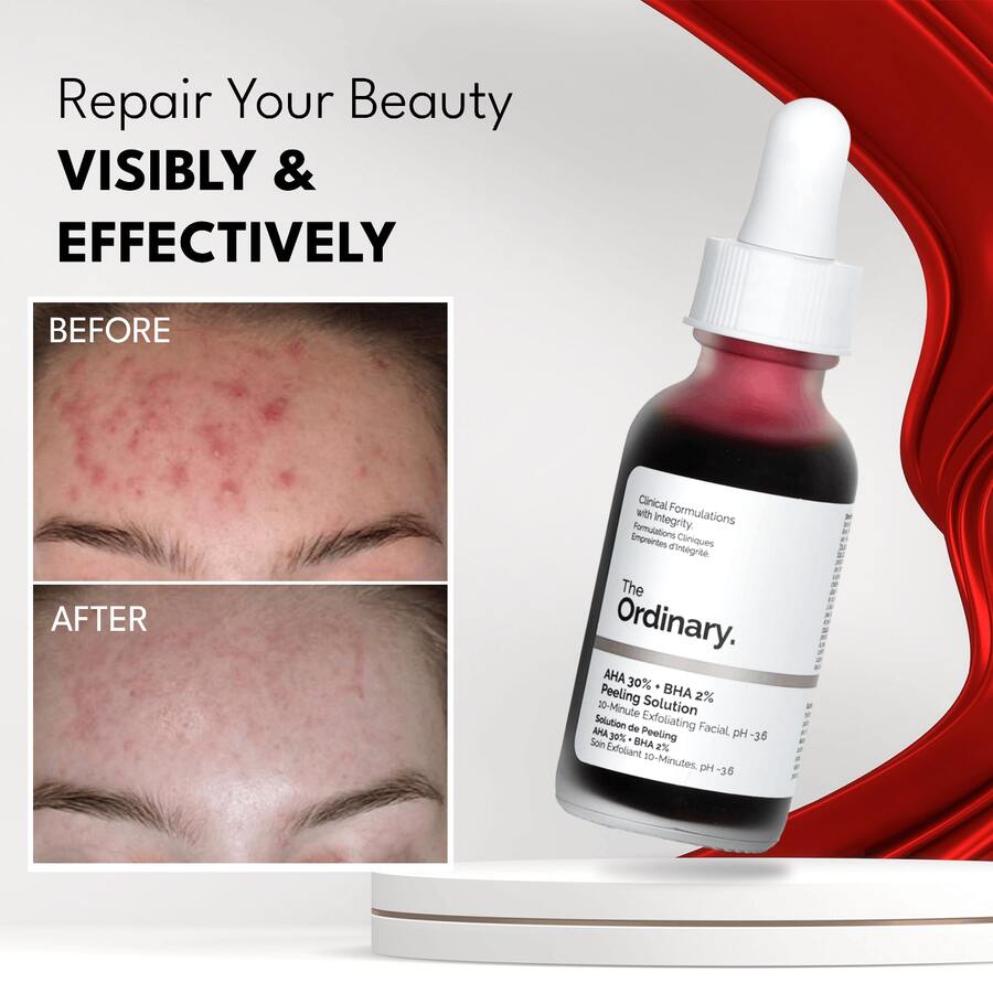 The Ordinary AHA 30% + BHA 2% Peeling Solution 1Oz/ 30ML X 2 (Pack Of 2 ...