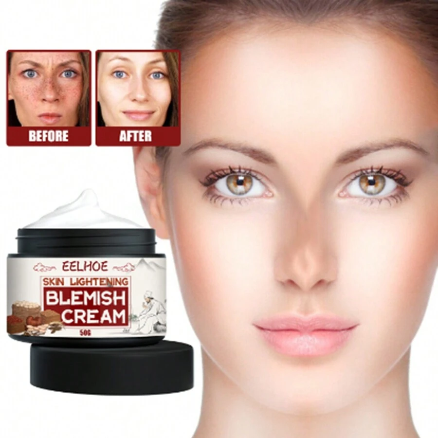 1pc 50g Spot Removing Face Cream Effective Removing Melasma Freckle Age ...