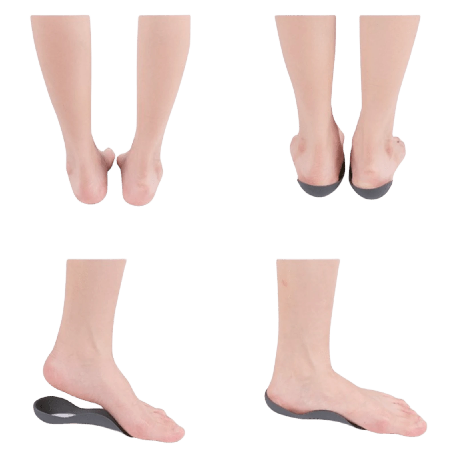 Arch Pad, Flat Foot Correction Insole, Arch Support, Flat Bottomed Foot ...