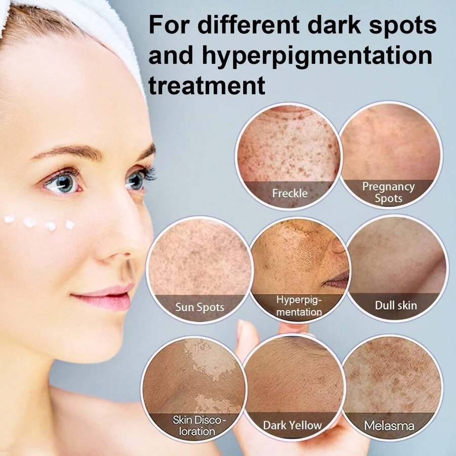 20ml Dark Spot Remover Cream,Anti-Dark Spot Fade Cream With Collagen ...