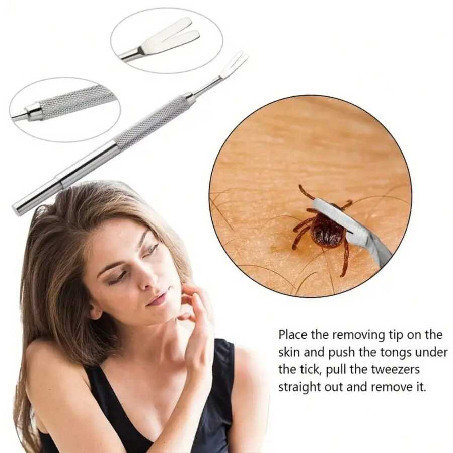 1pc /Stainless Steel Tick Remover, Stainless Steel Tick Fork, Tick ...