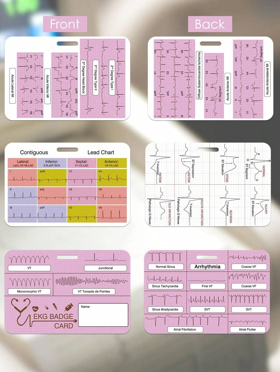EKG Cardiac Badge Card 3 Card Set, Stemi Badge Card EKG Telemetry ...