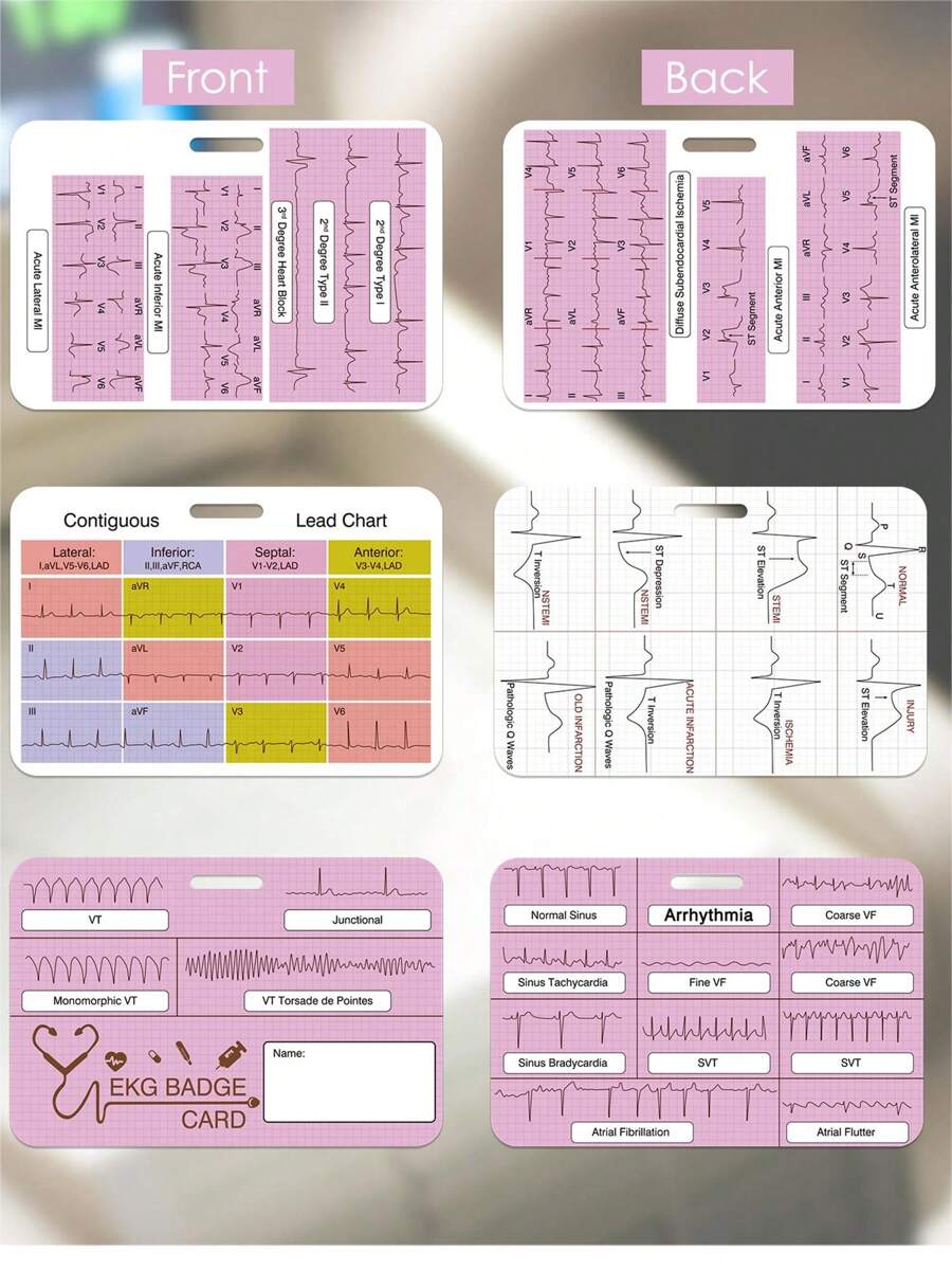 EKG Cardiac Badge Card 3 Card Set, Stemi Badge Card EKG Telemetry Interpretation Badge Buddy ...