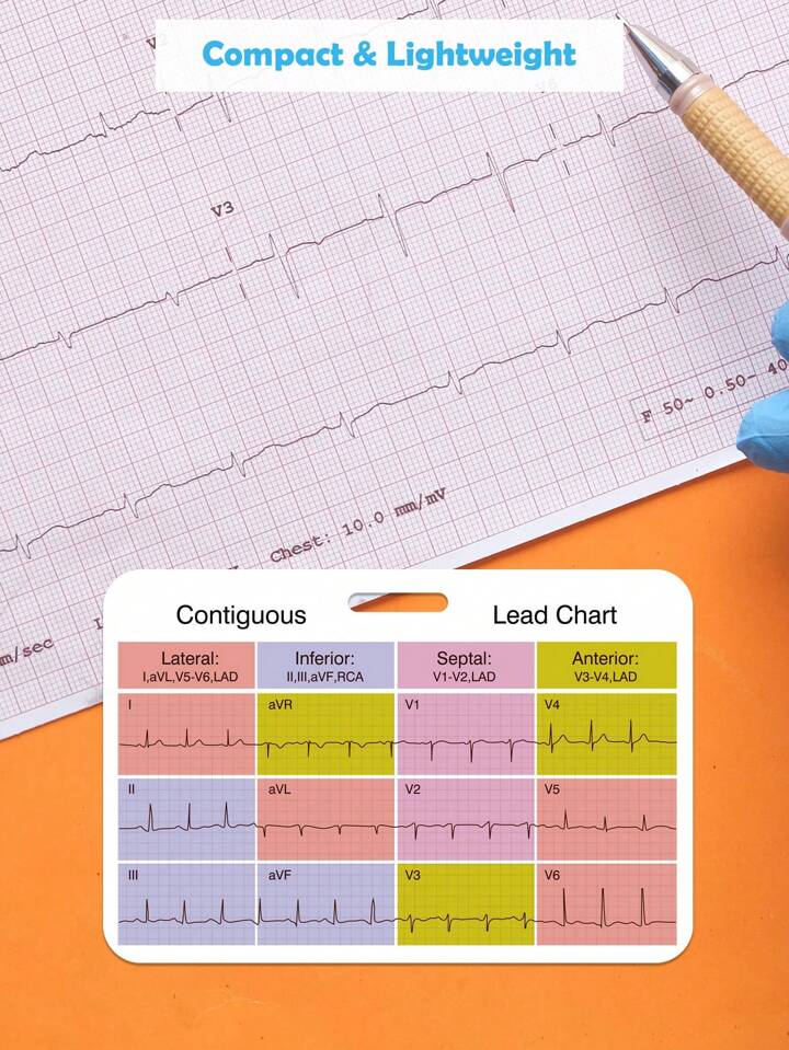 EKG Cardiac Badge Card 3 Card Set, Stemi Badge Card EKG Telemetry Interpretation Badge Buddy ...