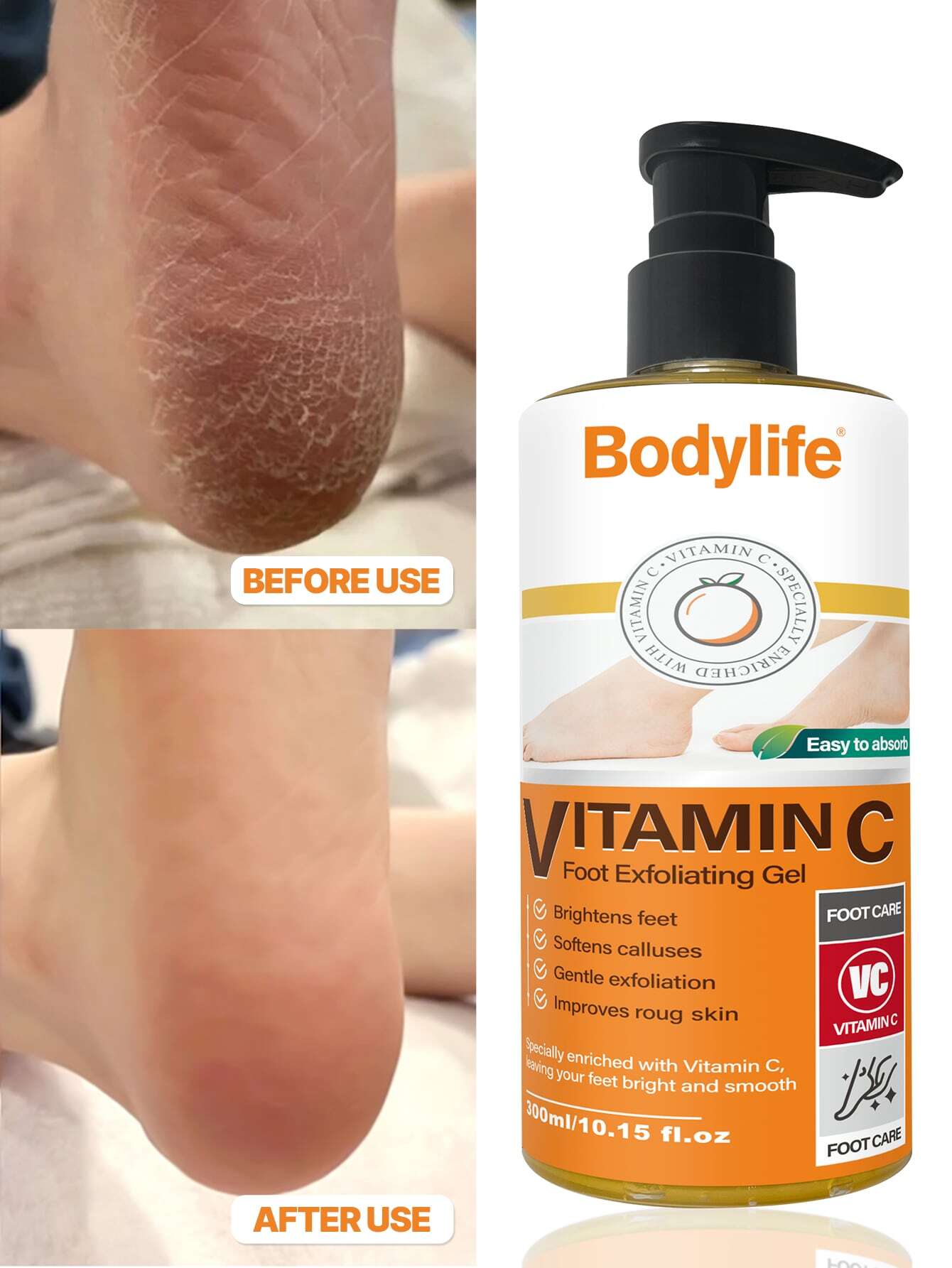 1 Bottle 300ml Vitamin C Foot Exfoliating Gel,For Dry And Cracked Heels ...