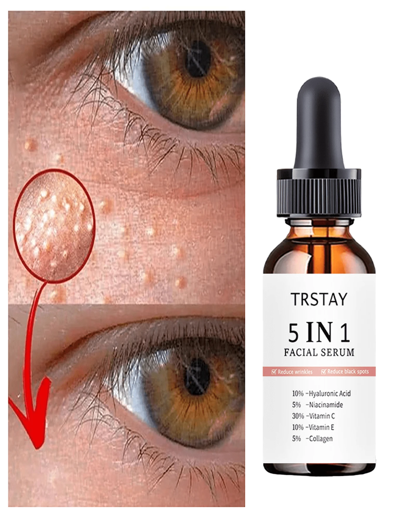Eye Lightening Acne Mark Essence | SHEIN USA