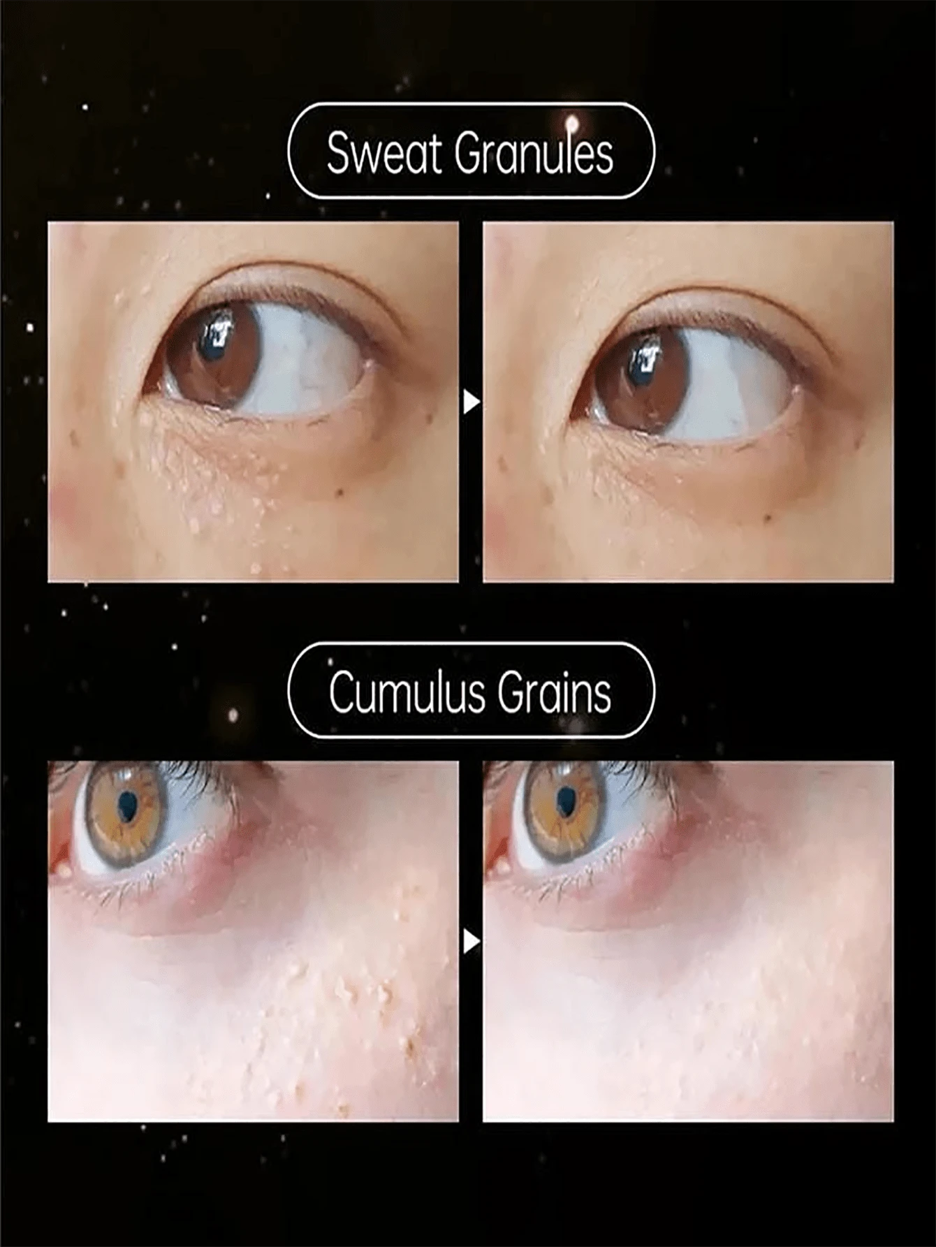 Eye Lightening Acne Mark Essence | SHEIN USA