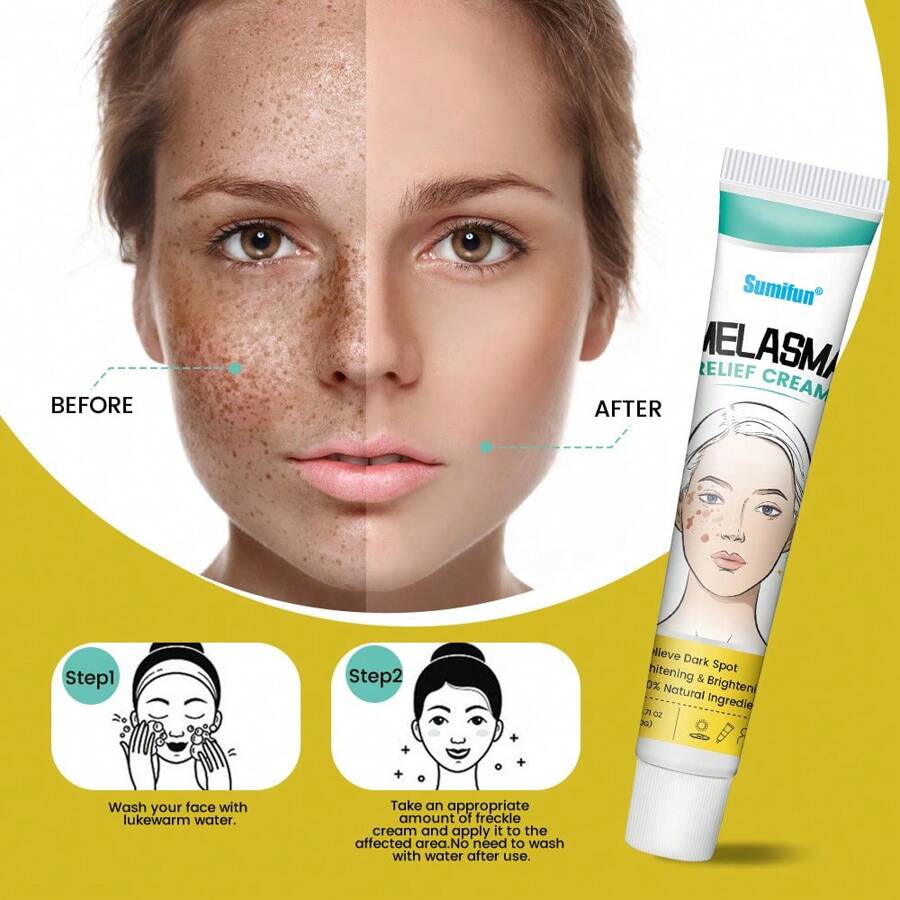 1pc 20g Brown Spot Skin Care Cream, Whitening & Beautifying Cream For Brown Spots, Improves Dull ...
