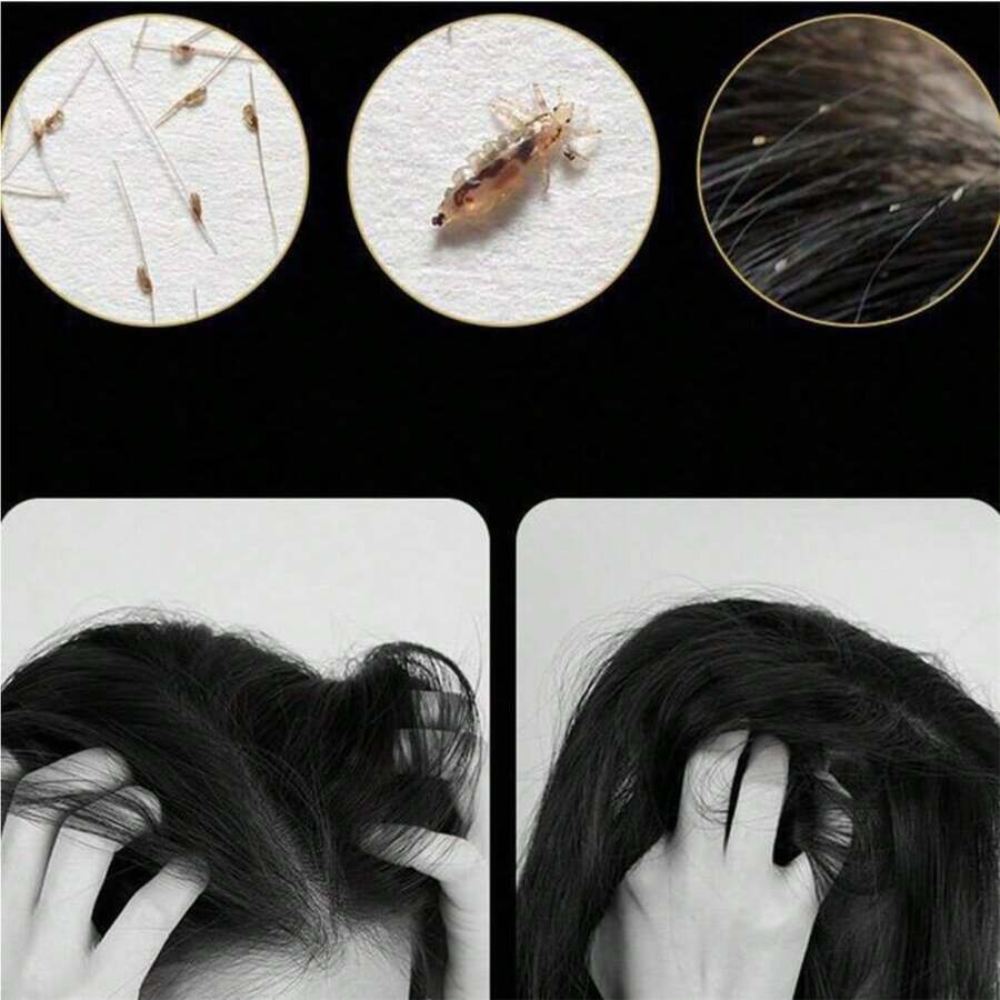Lice Comb, Fine Teeth Can Effectively Remove Lice And Nits, Scalp ...