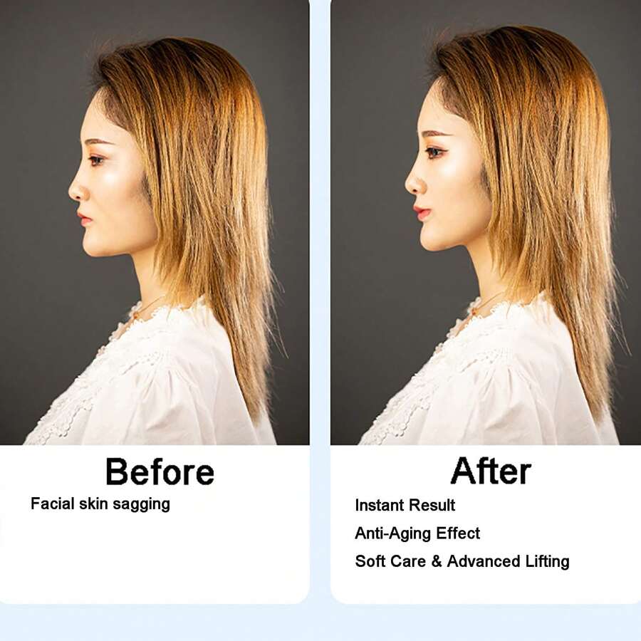 3 Pcs Invisible Face-Lift Headband, Reusable Reduce Wrinkles Daily With ...