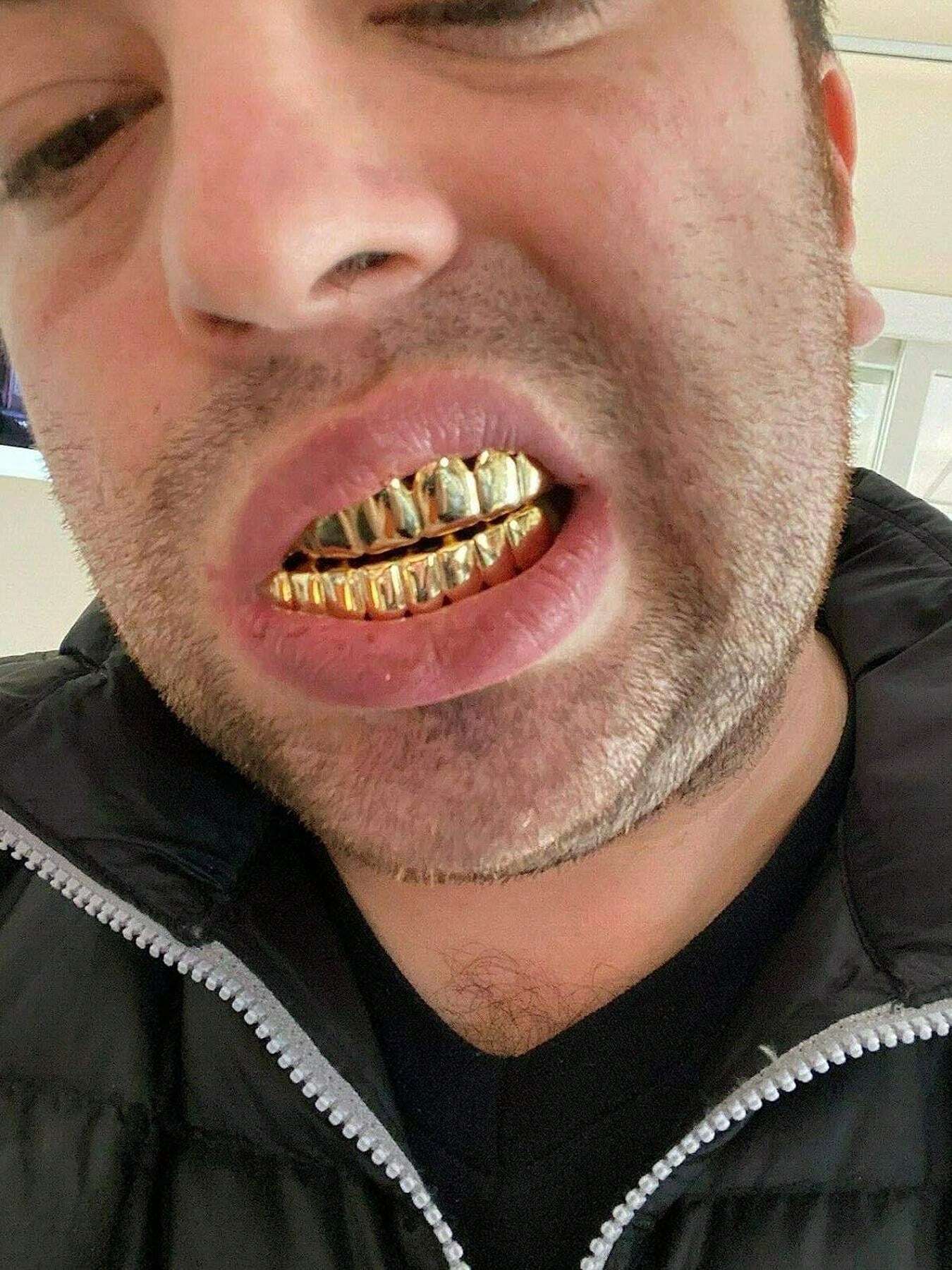 18K Golden Plated 16 Teeth Shiny Dental Grillz | SHEIN UK