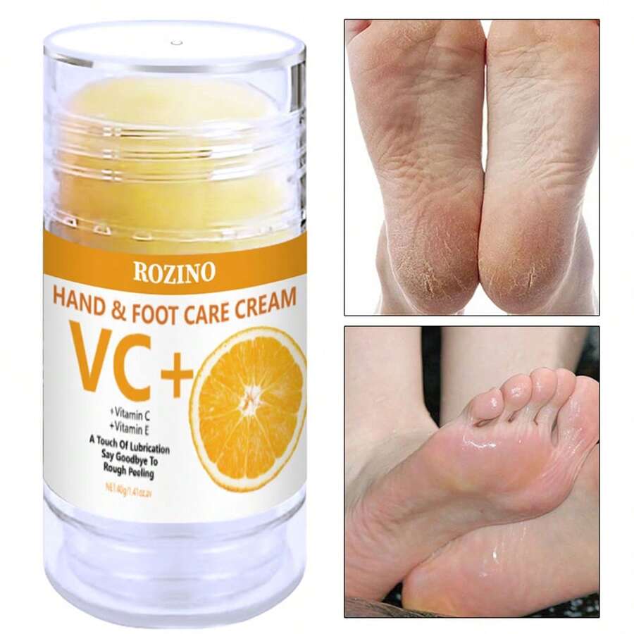 Rozino 40g Vitamin Hand & Foot Balm Cream, Nourishes And Moisturizes ...