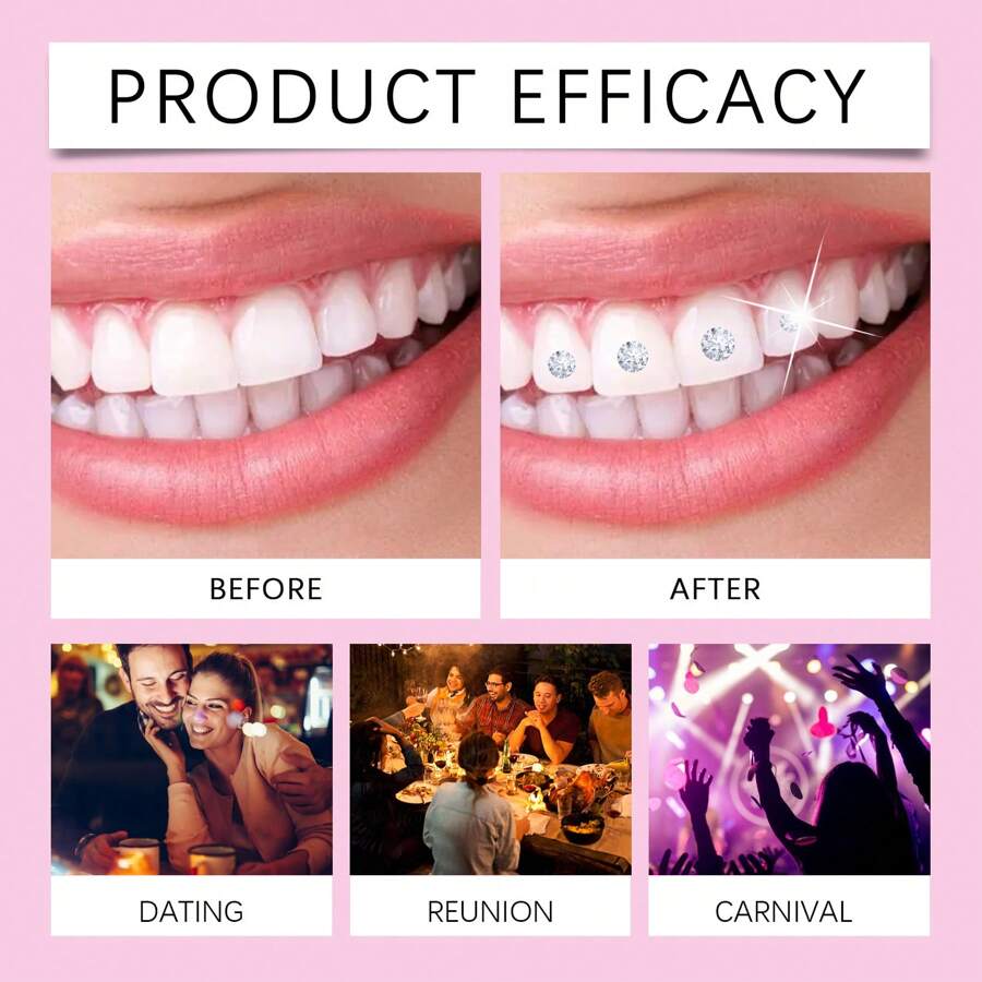 Tooth Gem DIY Kit - Fashionable, Sparkling Tooth Decorations For Dental ...