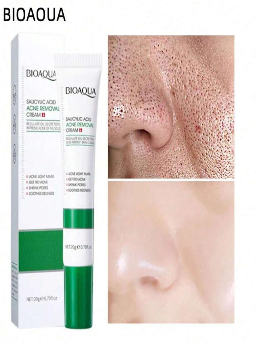 6 Acne Blackhead Remover Cream Bioaqua Salicylic Acid, Eliminates ...