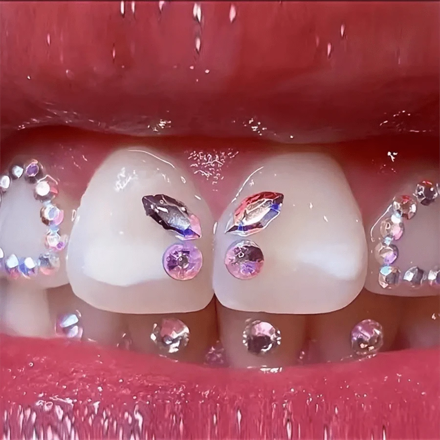Colorful Laser Tooth Gem Set Simple Butterfly Shape Tooth Jewelry ...