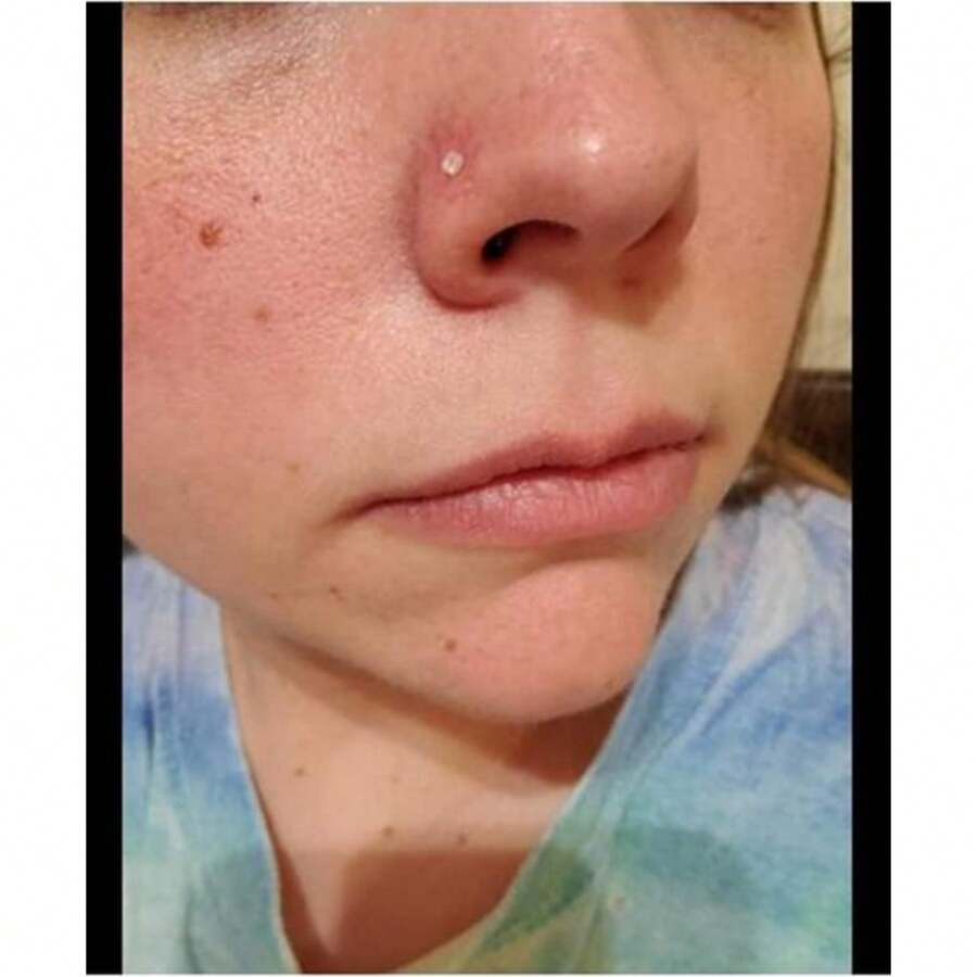 20pcs 18g Clear Nose Ring Retainer Bioflex L Shape Nose Rings Studs ...