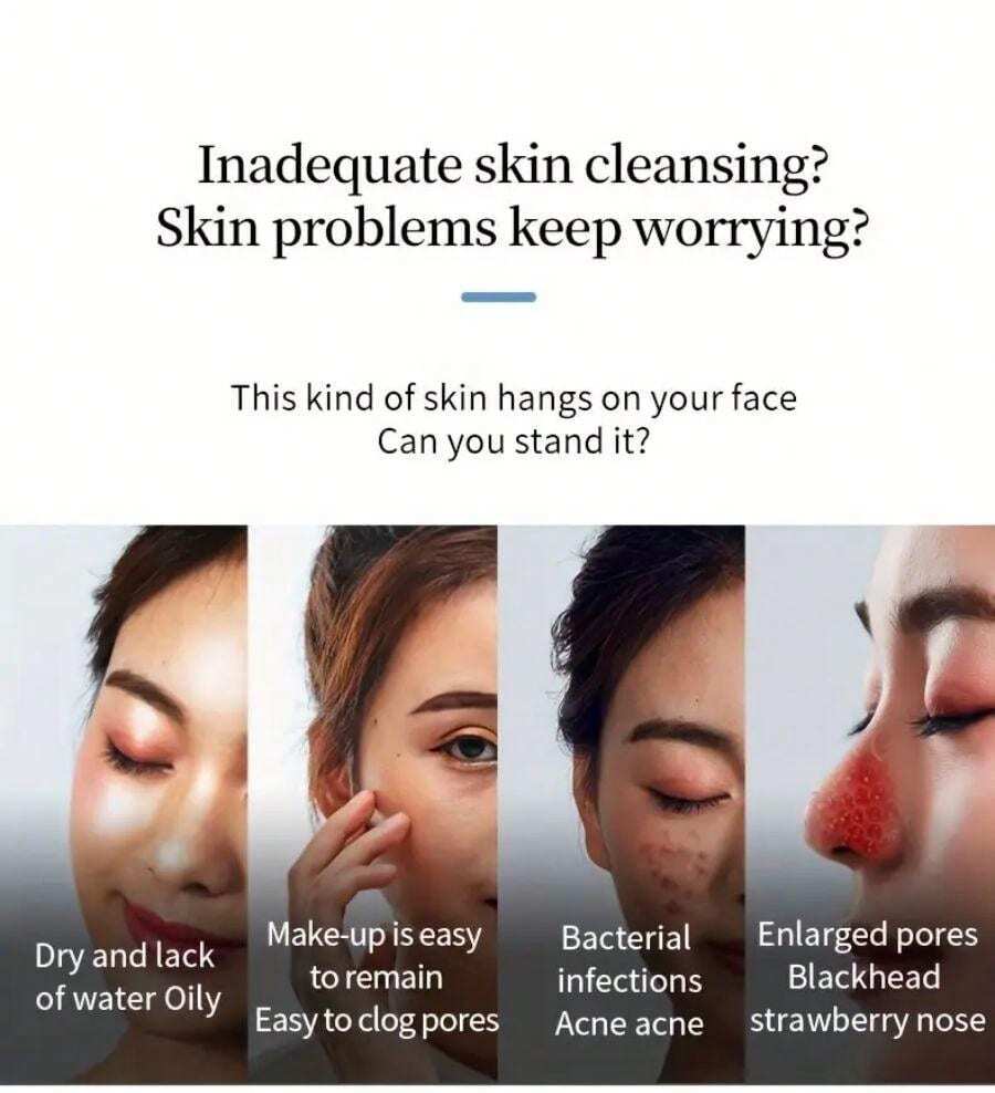 Black Head Remover Vacuum, Powerful Portable Face Pore Cleanser ...