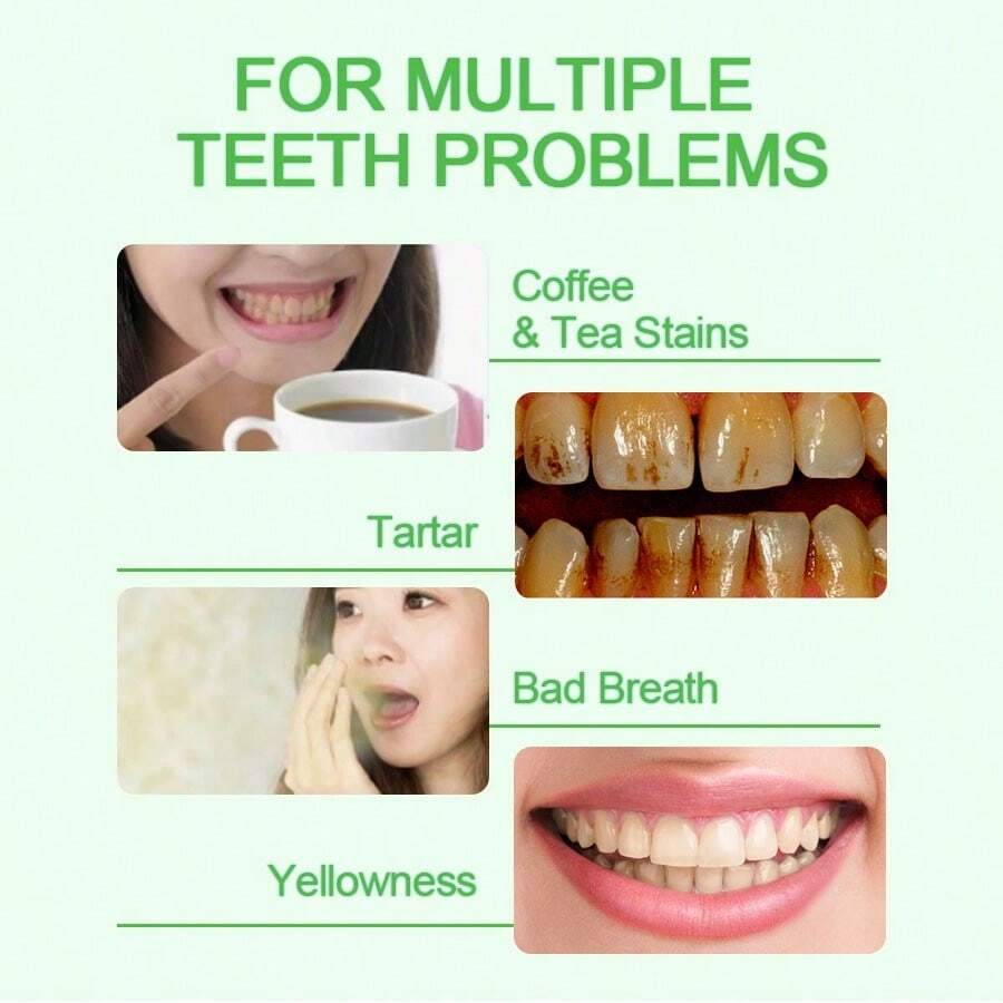 60ml Teeth Cleaning Mousse - Teeth Whitening, Plaque Removal, Fresh ...