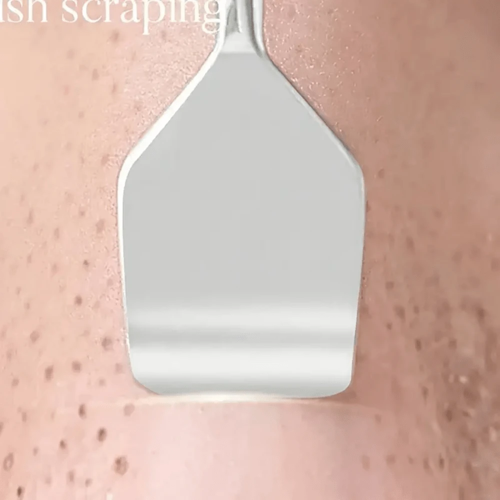 1pc Stainless Steel Blackhead Removal Scraper, Acne Needle, Double ...