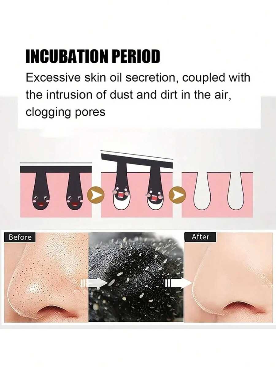 5/10/15/20/50pcs Nose Patches, Cleansing And Rejuvenating Nose Mask ...