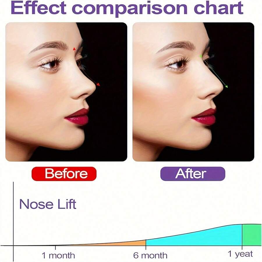 1pc Nose Bridge Heightener High Nose Bridge And Nose Wings Become ...