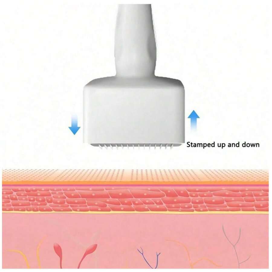 1pc Derma Stamp 100 Microneedle System Adjustable Microneedling Seal ...