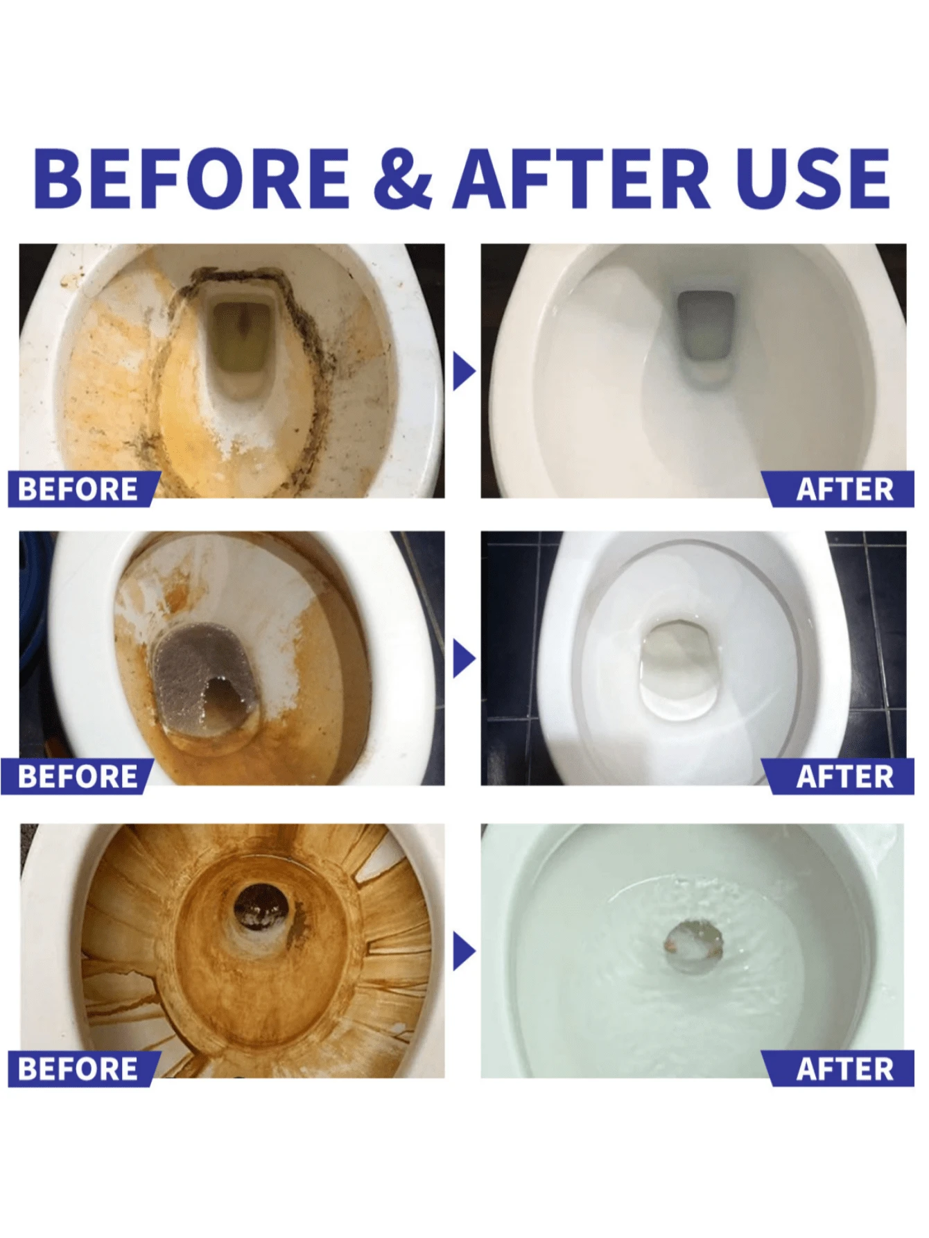 Toilet Bowl Cleaner Clean Toilet Bowl Urine Stains And Dirt To Remove ...