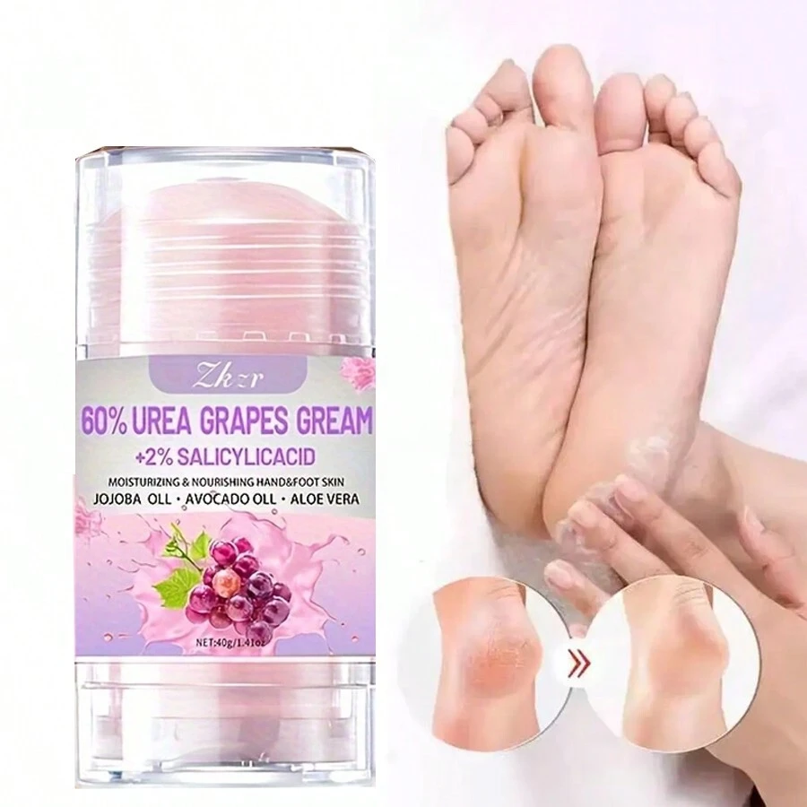 1 Tube Of 60g Grape Fissure Cream, With Functions Of Whitening, Deep ...