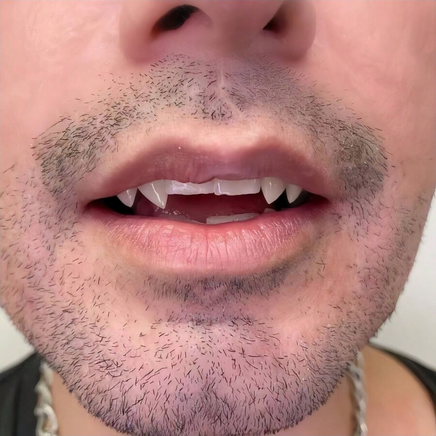 THATBOY 2PCS/SET Vampire Teeth Fangs Werewolf Teeth Cosplay Prop ...