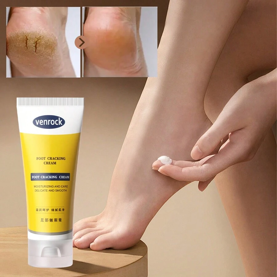 1 x 60g Creme para os Pés - Repara Calcanhar Seco e Rachado e Pele ...